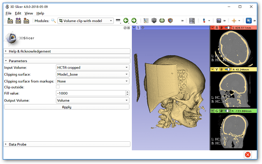 天天练042-体数据模型剪切法（Volume clip with Model）1 - 天天练 - 3DSlicer中文论坛