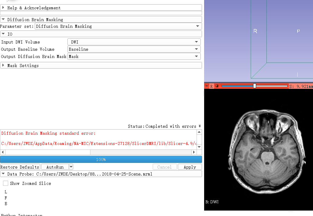 DTI数据导入问题请教 - 问题求助 - 3DSlicer中文论坛