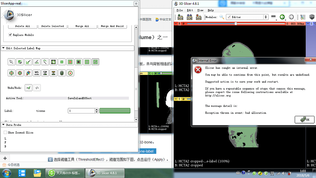 天天练019-标签映射体数据（Label map Volume）之一 - 天天练 - 3DSlicer中文论坛