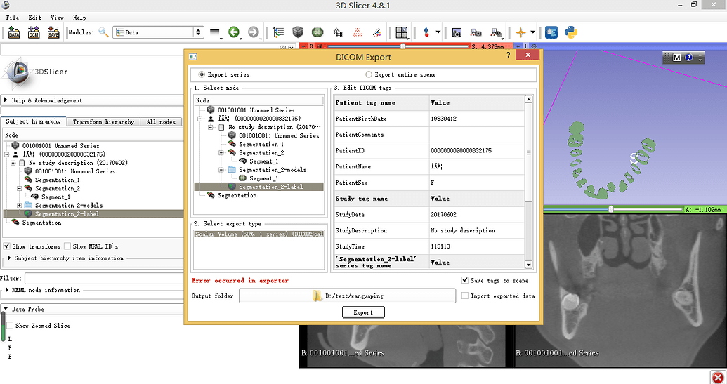 给我大佬们，我用3D Slicer分割后重建的三维图像导出.dcm格式出现了问题，希望大佬们能指点迷津，不吝赐教，谢谢 - 问题求助 - 3DSlicer中文论坛