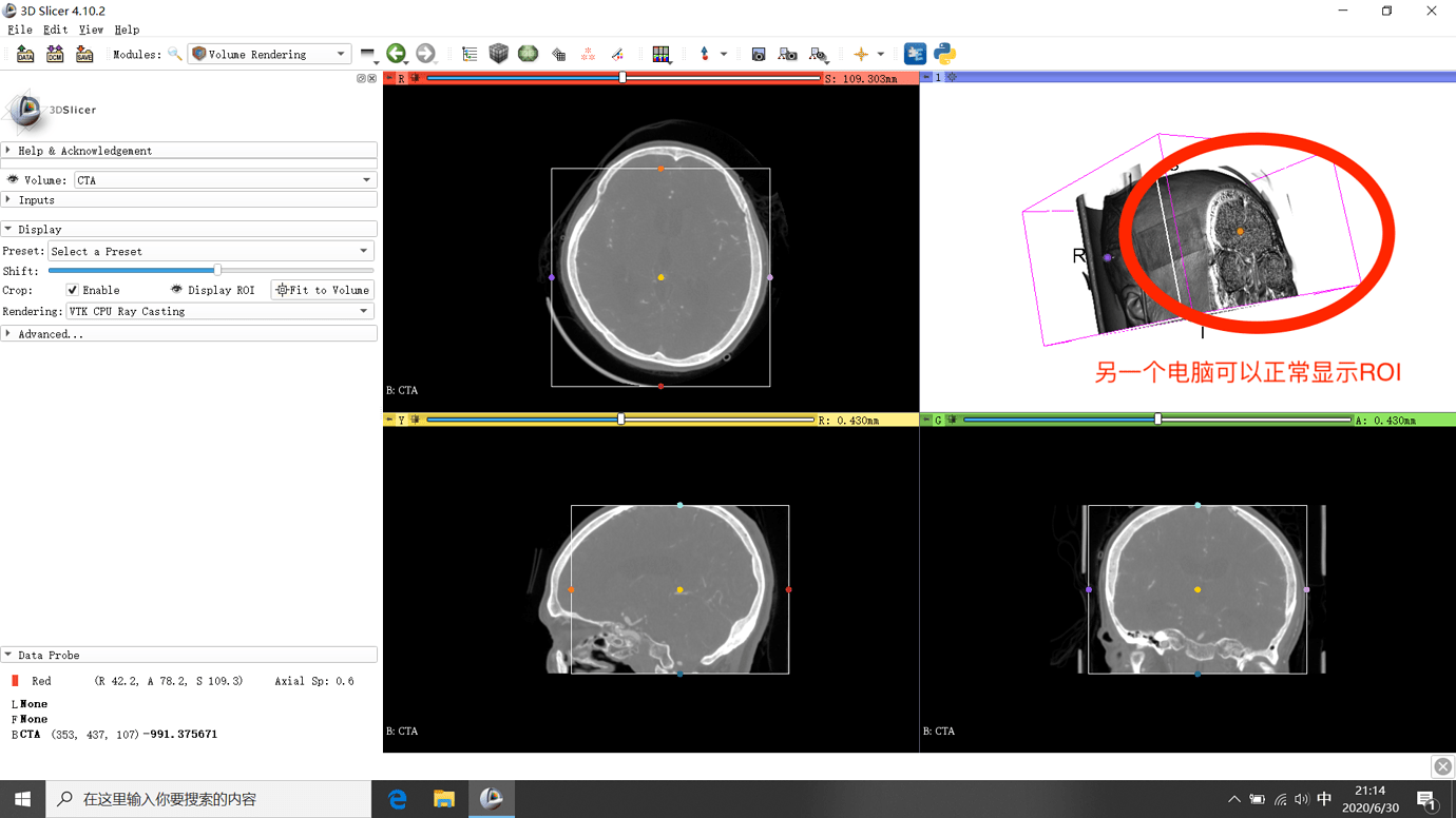 ROI无法显示 - 问题求助 - 3DSlicer中文论坛