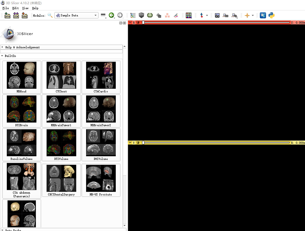 导入DICOM文件总不正常 - 问题求助 - 3DSlicer中文论坛