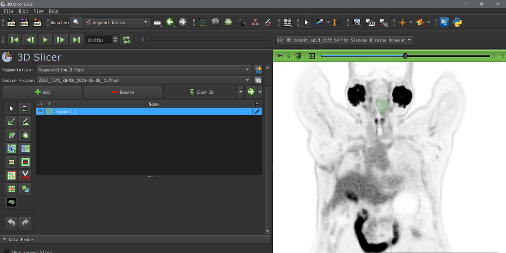 如何改变导入的ROI的位置 - 软件教程 - 3DSlicer中文论坛