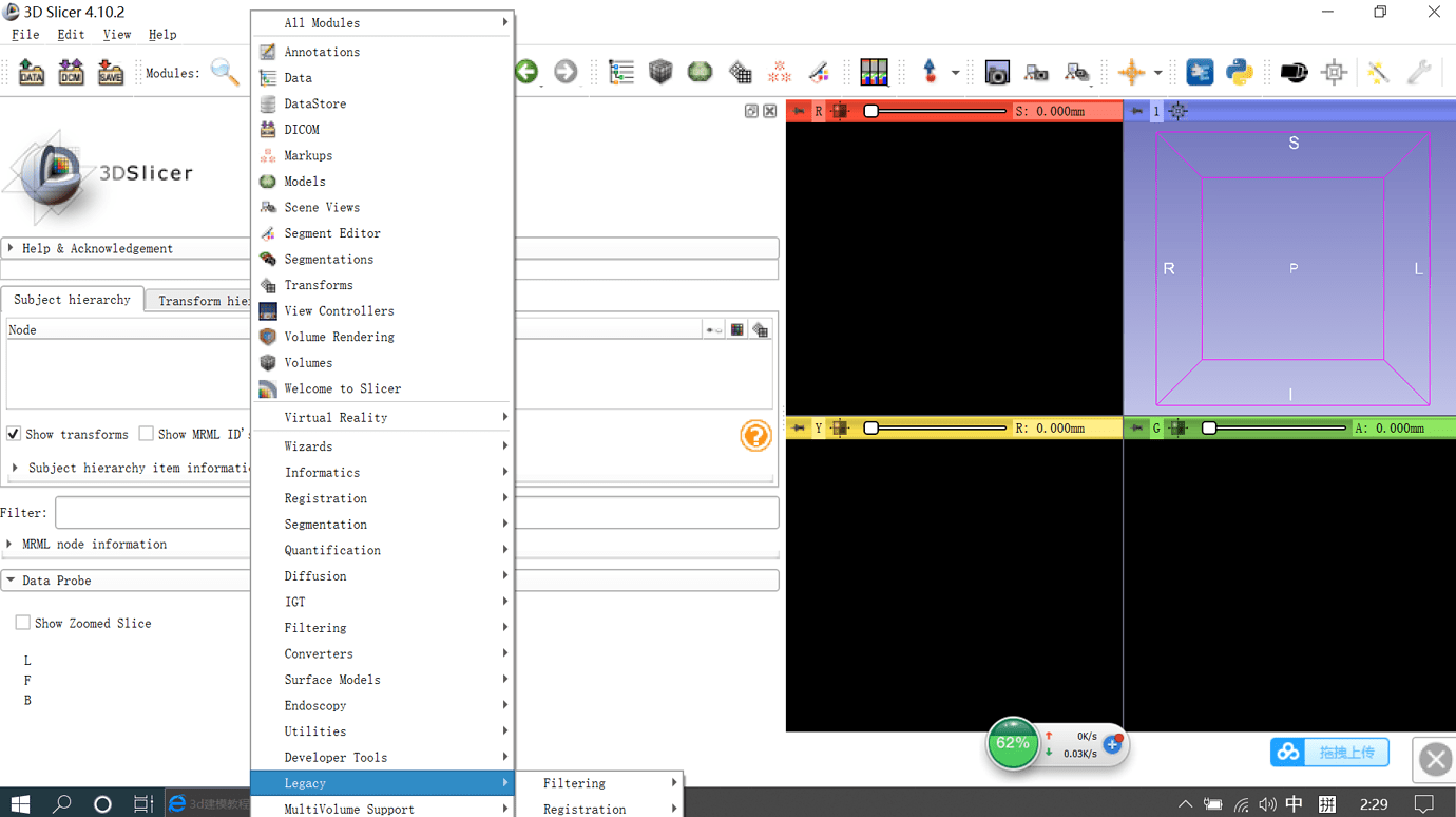 Editor模块找不到？ - 问题求助 - 3DSlicer中文论坛