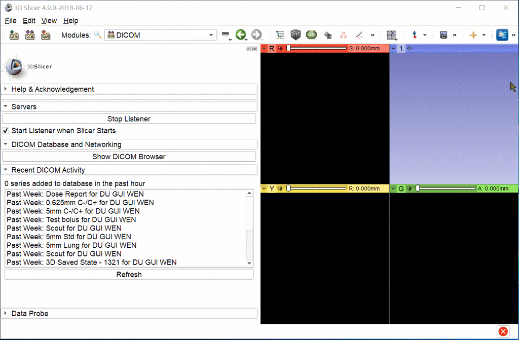 DTI教程02-DWI数据加载 - 3DSlicer | DTI - 3DSlicer龙虾社区
