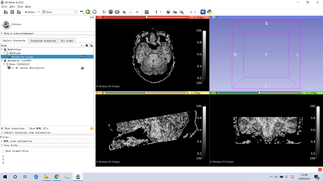 导出DICOM格式的DTI的FA图像，导出的DICOM文件无数据显示 - 问题求助 - 3DSlicer中文论坛