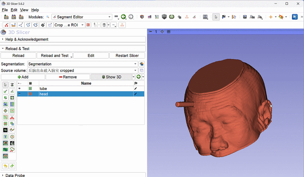第十二篇：导板剪裁 - 3D打印 - 3DSlicer中文论坛