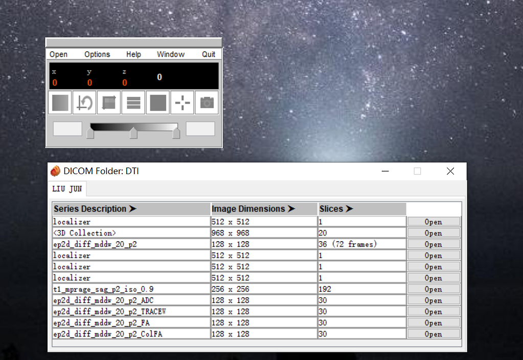 使用mango后仍然无法导入DTI数据 - 问题求助 - 3DSlicer中文论坛