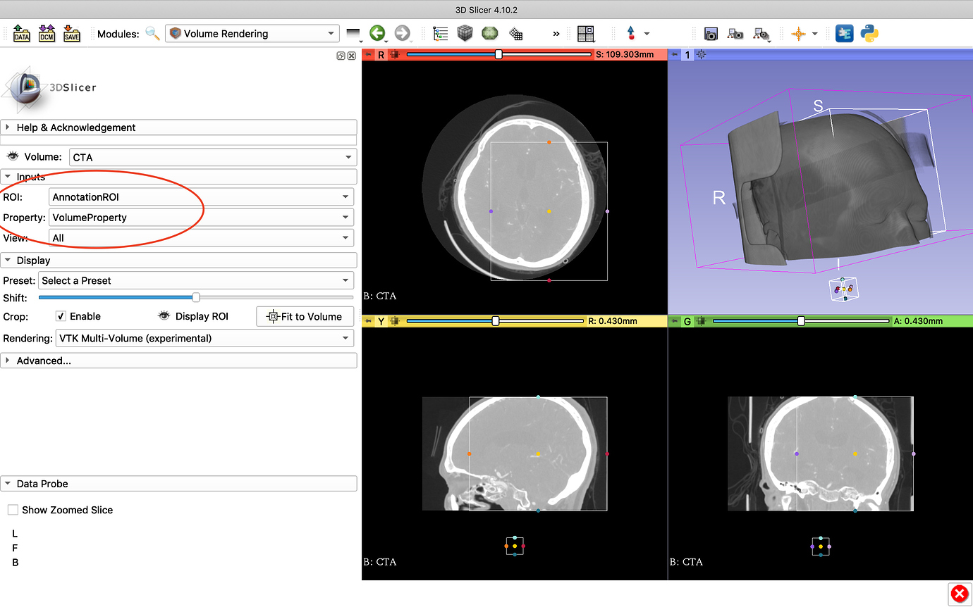ROI无法显示 - 问题求助 - 3DSlicer中文论坛