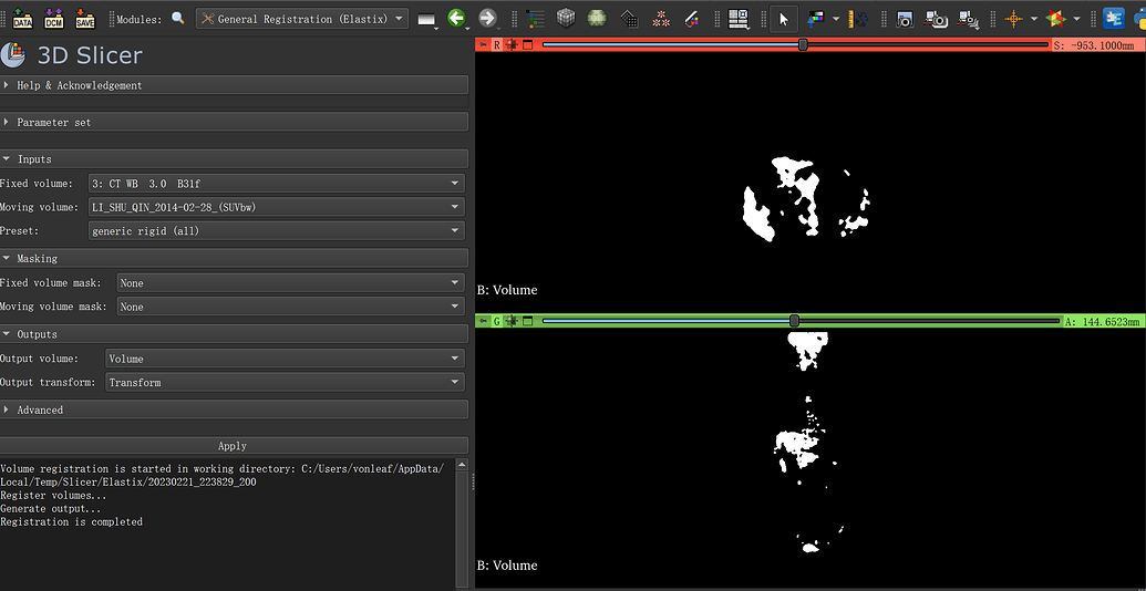 为什么我将PET图像和CT图像配准后产生的图像volume值只有0和1 - 问题求助 - 3DSlicer中文论坛