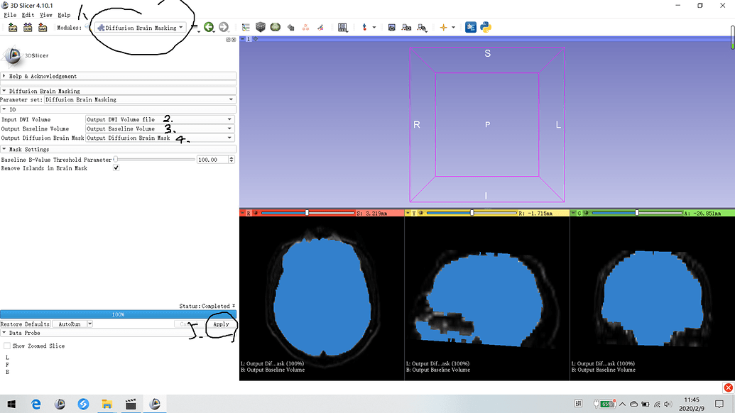 联影磁共振DTI数据导入 - 经验分享 - 3DSlicer中文论坛