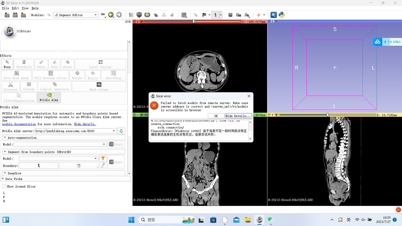 Nvidia AIAA的全自动分割功能不能使用 - 问题求助 - 3DSlicer中文论坛