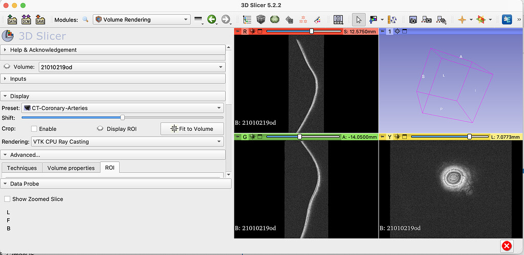 volume rendering不显示渲染效果 - 问题求助 - 3DSlicer中文论坛