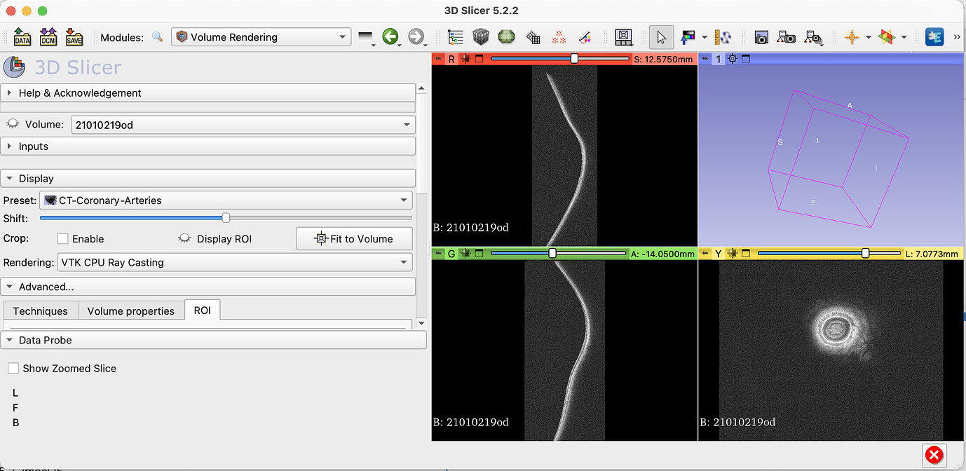 volume rendering不显示渲染效果 - 问题求助 - 3DSlicer中文论坛