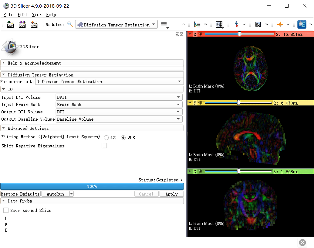 应用 Dcm2niigui转换DTI数据用于3DSlicer方法 - 软件数据 - 3DSlicer中文论坛
