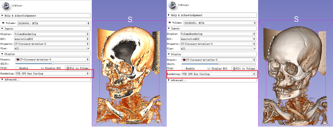 天天练008-体绘制（3D渲染）基本设置 - 天天练 - 3DSlicer中文论坛