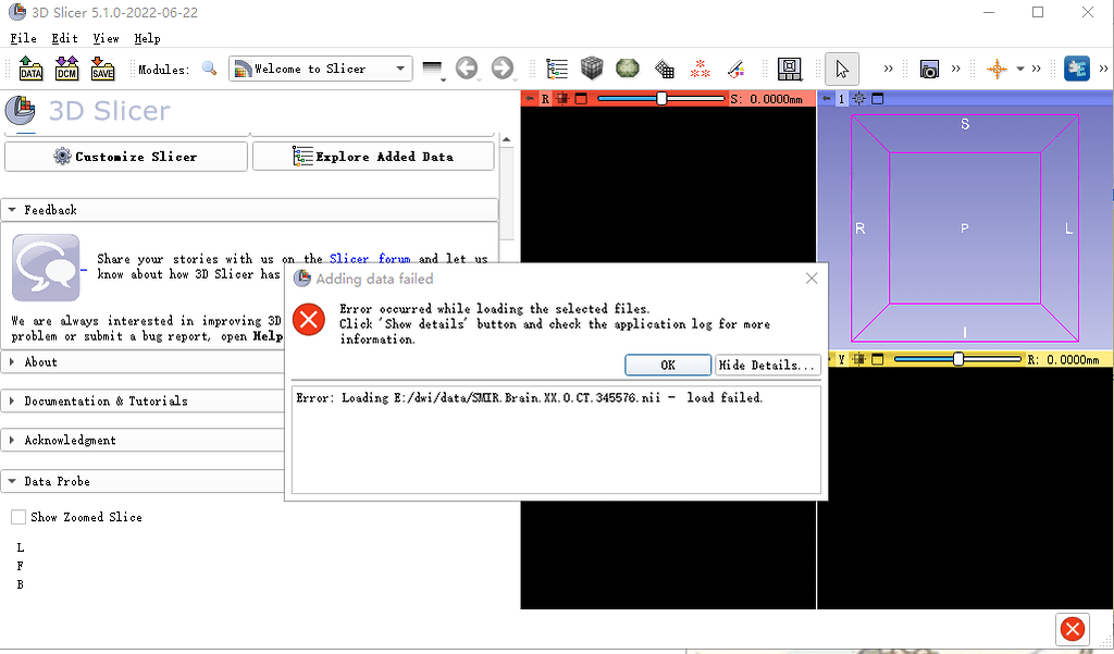 用的slicer是5.1.0版本的，为什么将nii文件直接拖入3d slicer中，会加载文件失败啊？ - 问题求助 - 3DSlicer中文论坛